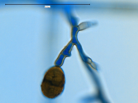Fun With Microbiology (What's Buggin' You?): Stemphylium species
