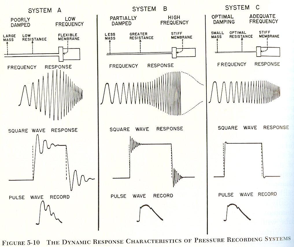 Pedi cardiology: Radial A line trace...why is it like that?!