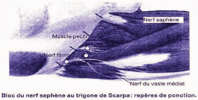BLOC DU NERF SAPHÈNE ~ Médecine en français