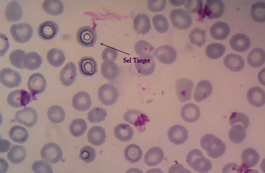Pengenalan Morfologi Sel Erytrosit | Analis Kesehatan