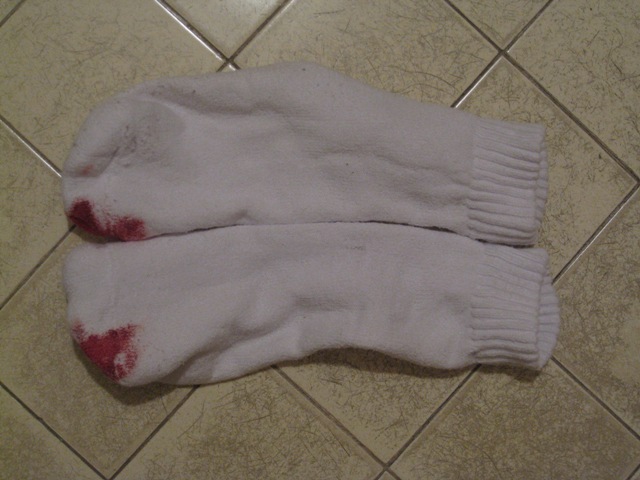 woggingtortoise: Injured and Didn't Realize It Until Midway During a ...