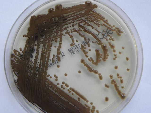 ATLAS MICOLOGIA: EXOPHIALA JEANSELMEI