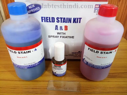 Blood Smear Slide Staining कैसे करते हैं - Field Stain ~ Lab Test Hindi