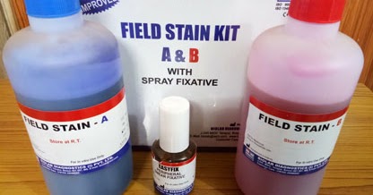 Blood Smear Slide Staining कैसे करते हैं - Field Stain ~ Lab Test Hindi