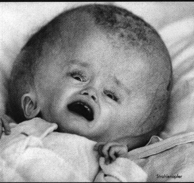 Mutations chernobyl aftermath - bearkopol