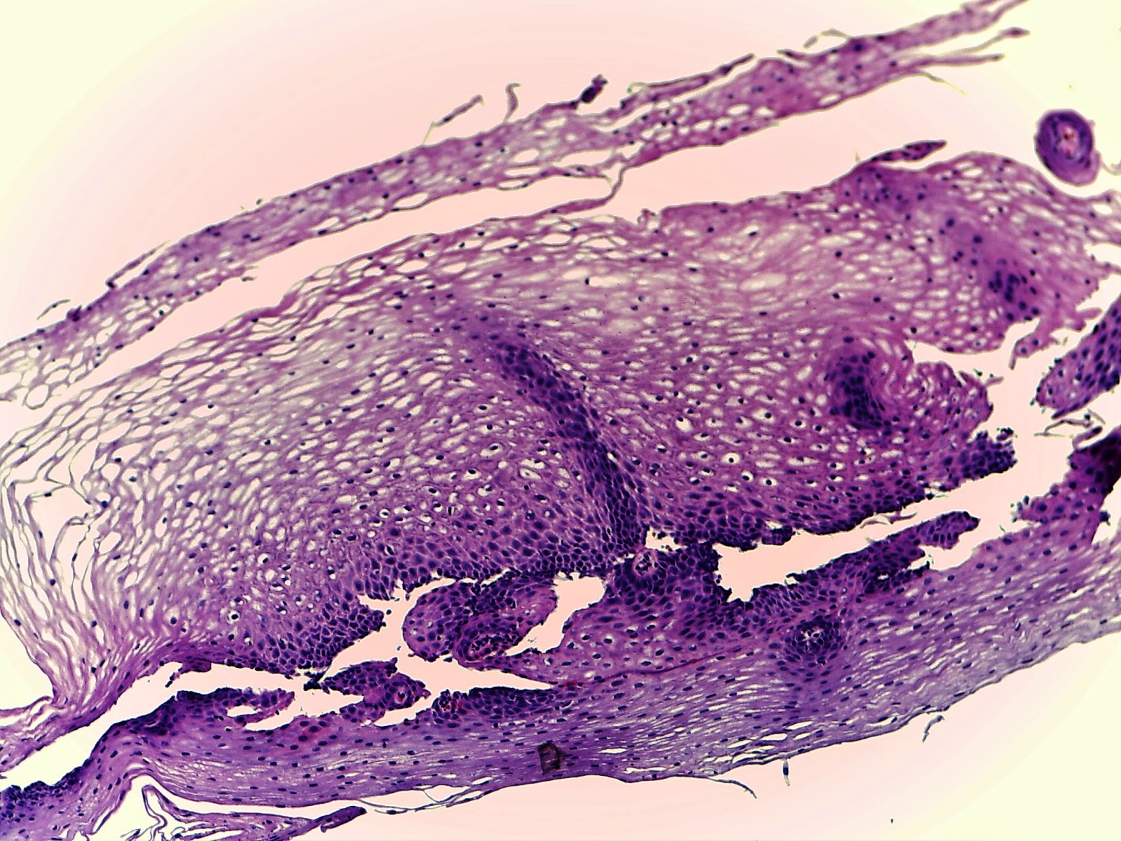 GASTROINTESTINAL AND LIVER HISTOLOGY PATHOLOGY ATLAS: ESOPHAGUS ...