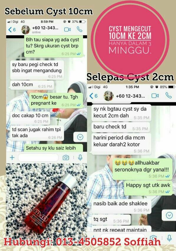 Wanita Menyangka Hamil Rupanya Cyst Sebesar 10cm Dalam Rahimnya ~ Cara ...
