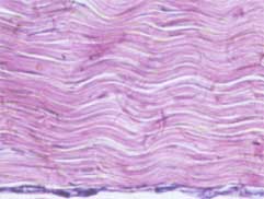 Tissue Bio Lab: Connective Tissue!!!!!