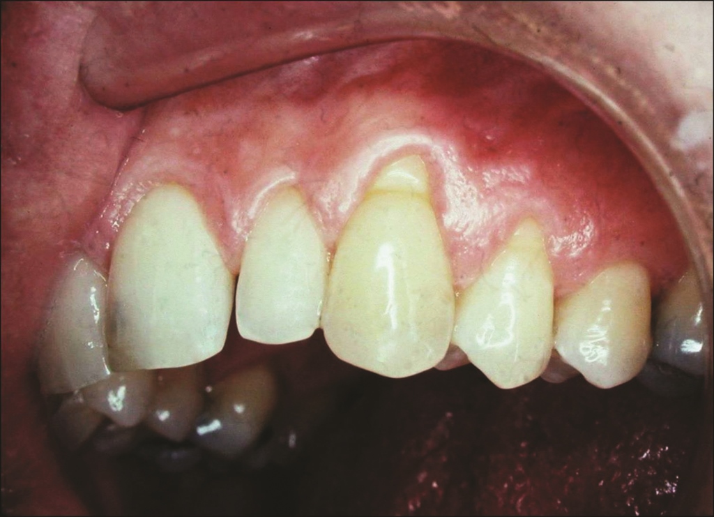 pagină de autor: Cabinet stomatologic. Tratament paradontoza