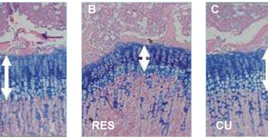 Treating Achondroplasia: Treating achondroplasia: BMN-111 and the catch ...