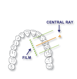 Dentistry and Medicine: Intraoral Radiographic Techniques (The ...