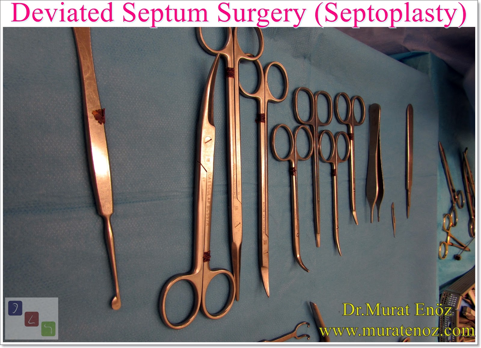 Correcting The Deviated Septum