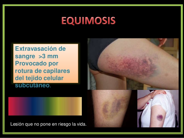 Traumatología Médico-Legal (UNED,CR-2017)