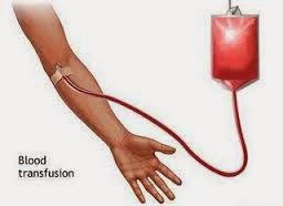 HEMATOLOGI: DASAR-DASAR TRANSFUSI DARAH
