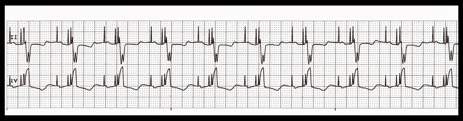 Float Nurse: January 2015