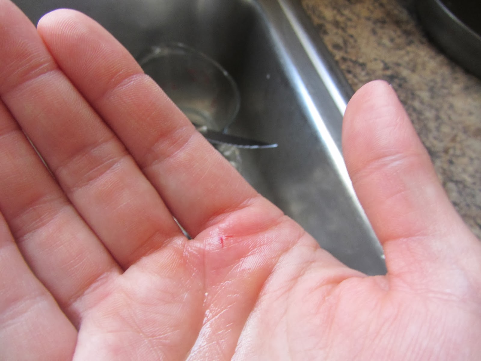 Purification Essenial Oil to Clean Wounds