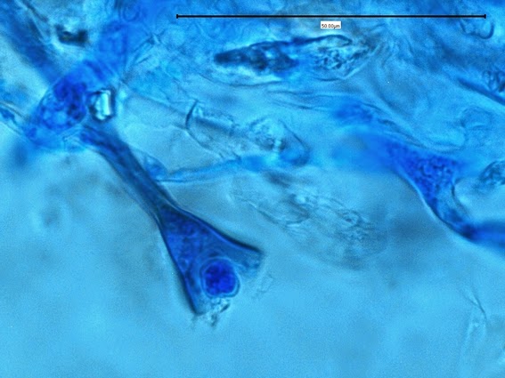 Fun With Microbiology (What's Buggin' You?): Apophysomyces elegans ...