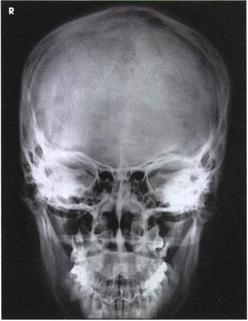 Sahabat Afterego: Prosedur Pemeriksaan Radiograf Cranium