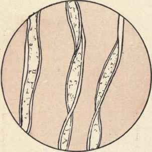 Forensics: Forensics Project Part II: Hair and Fiber Analysis