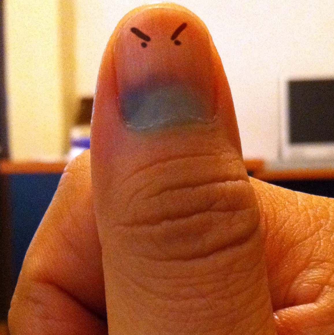 PRIMEROS AUXILIOS: HERIDAS