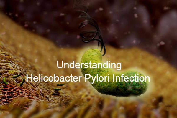 Understanding Helicobacter Pylori Infection
