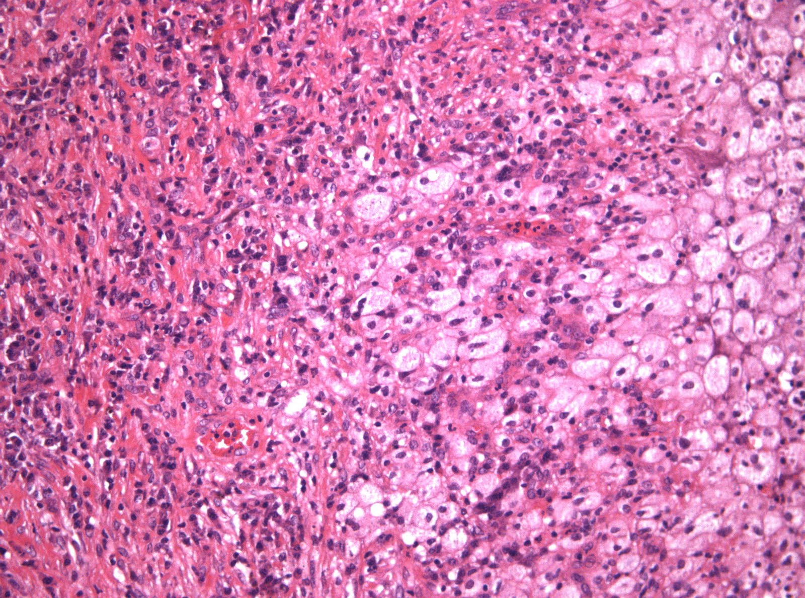 ATLAS ELECTRONICO HISTOLOGIA HUMANA: BREVE INTRODUCCIÓN A LA PATOLOGÍA ...