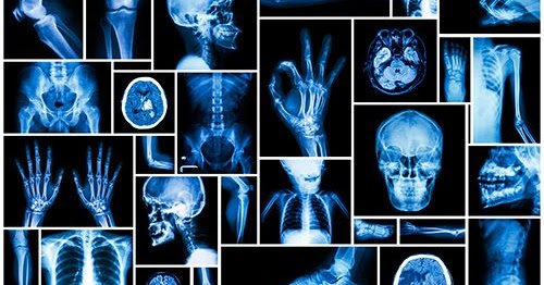 Radiologia em Foco: O que é Radiologia?