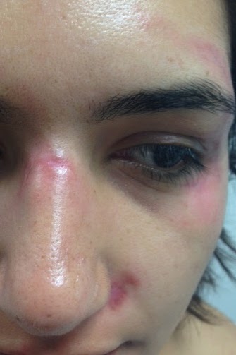 Ana Cristina Diniz - Dermatologia Estética - Cosmetic Dermatology ...