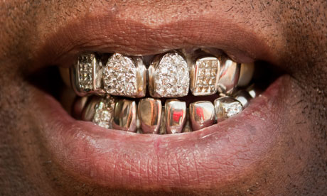 Fenryss: GOLD TEETH COLECTION