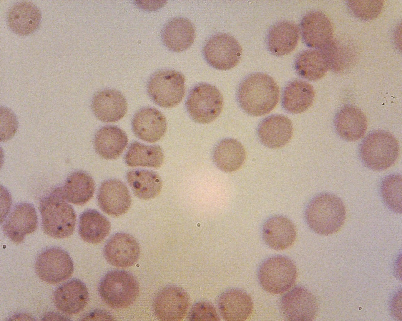 CLÍNICA VETERINARIA (NORTON) DR. MARCELO CANDO : Mycoplasma Haemofelis