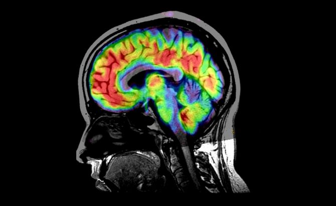 La enfermedad de la piel azul