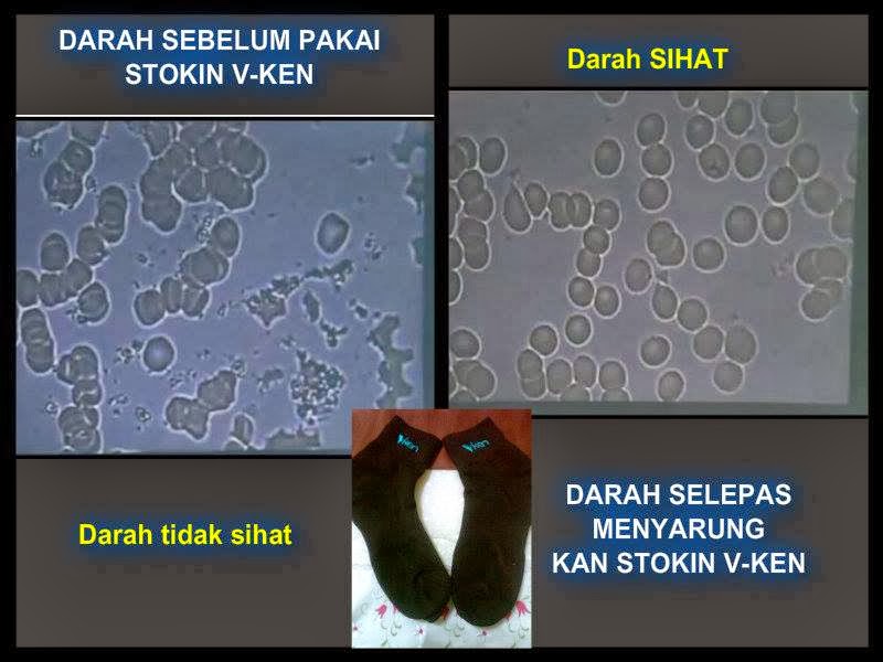 STOKIN KESIHATAN VKEN..MEMANG AJAIB!!!!! |vken stokin kesihatan ajaib