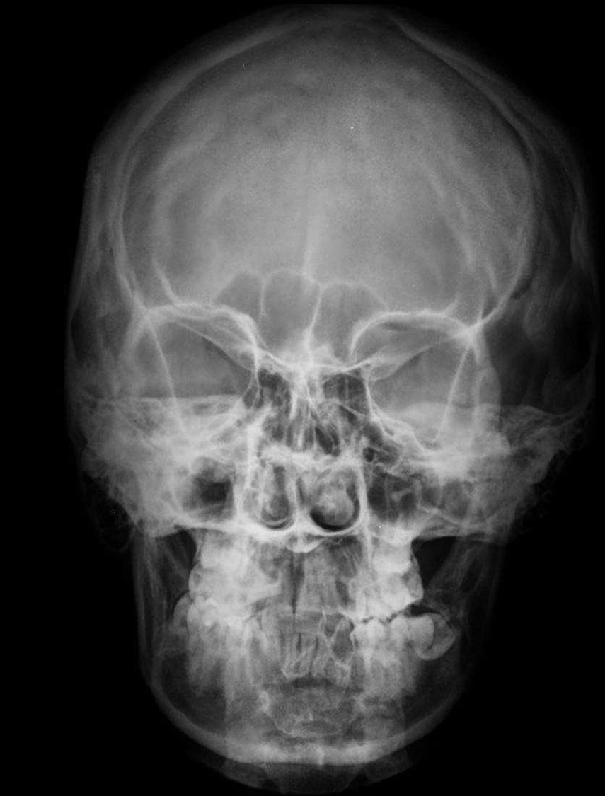 LABORATORIO DE IMÁGENES: 2017