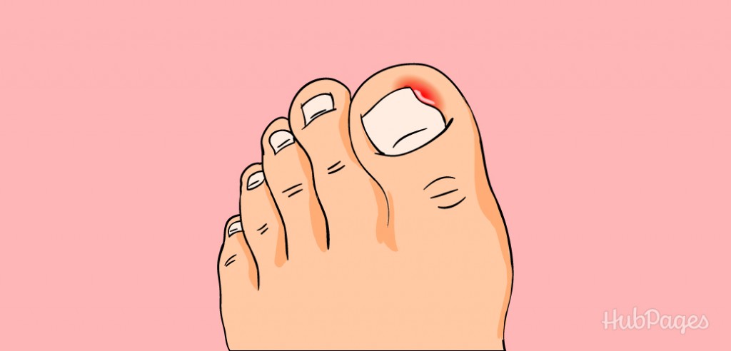 Teach your Students How to Cut Nails - Nail Cutting methods | School ...