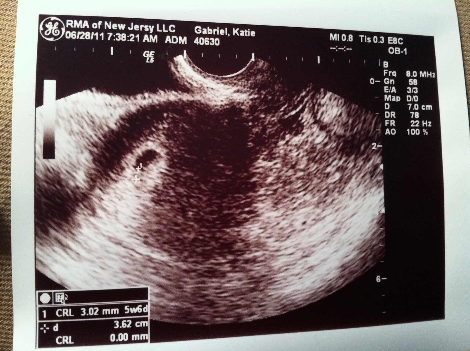 Dear Hope: Ultrasound Pictures