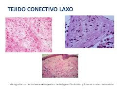 HISTO-EMBRIOLOGIA: TEJIDO LAXO