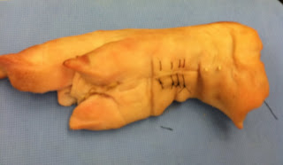 A Doctor in the Works: Surgery: Day 4