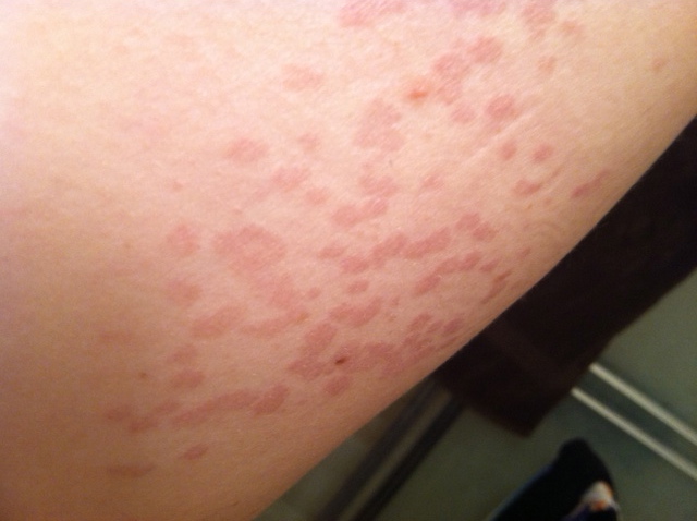 Mistress of the Method: Scattered, Smothered, Covered and CHUNKED.