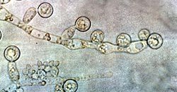 Hongo Candida albicans: Hongo Candida albicans