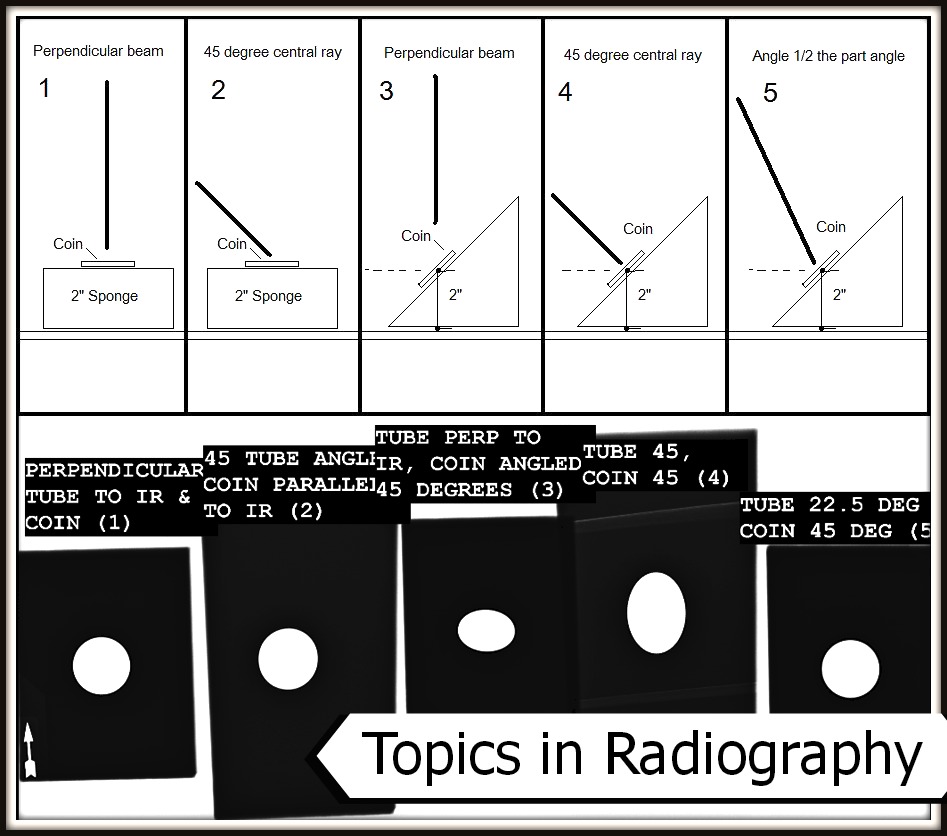 Topics in Radiography: Shape Distortion