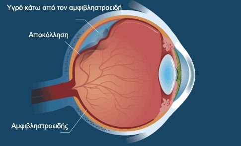 ΤΟ ΗΜΕΡΟΛΟΓΙΟ ΤΟΥ ΑΝΤΩΝΗ ΤΡΙΦΥΛΛΗ : Τι είναι και πώς αντιμετωπίζεται η ...