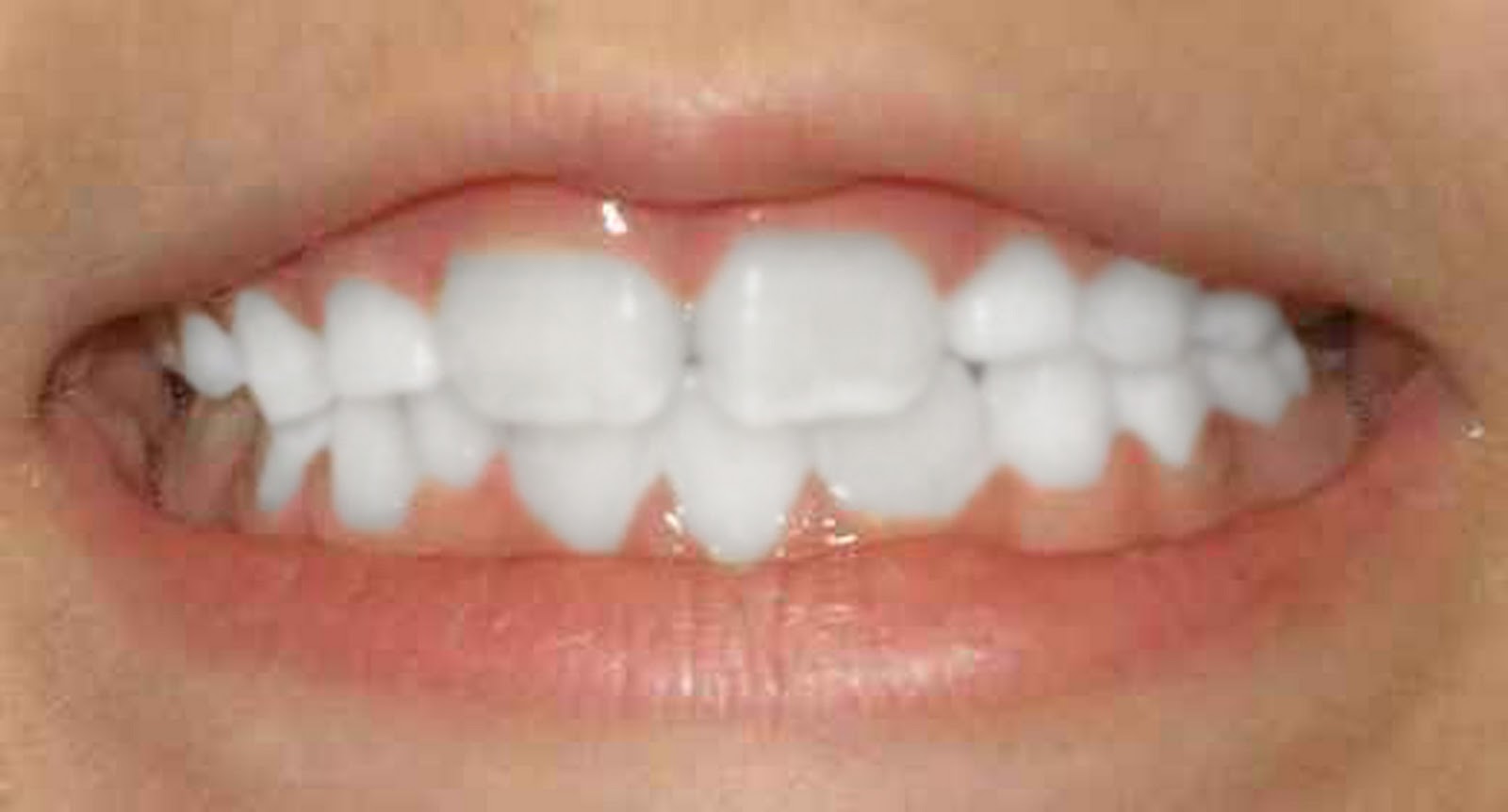 Photography Weekly: Fat to skinny, bad teeth to good