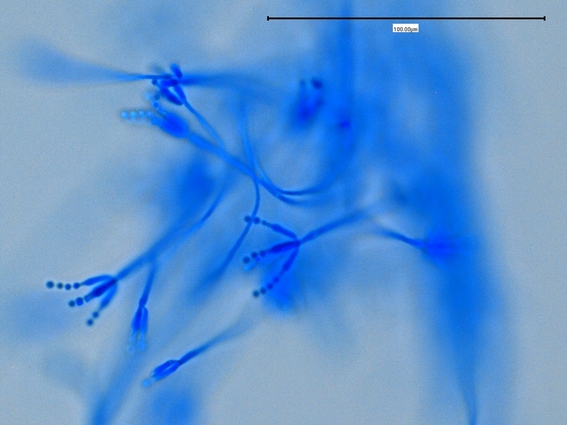 Fun With Microbiology (What's Buggin' You?): Penicillium citrinum