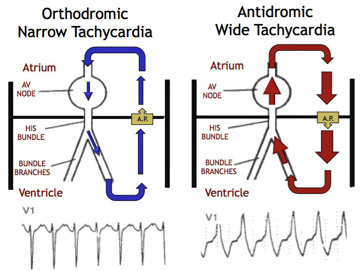Emergency Medicine PharmD: September 2014