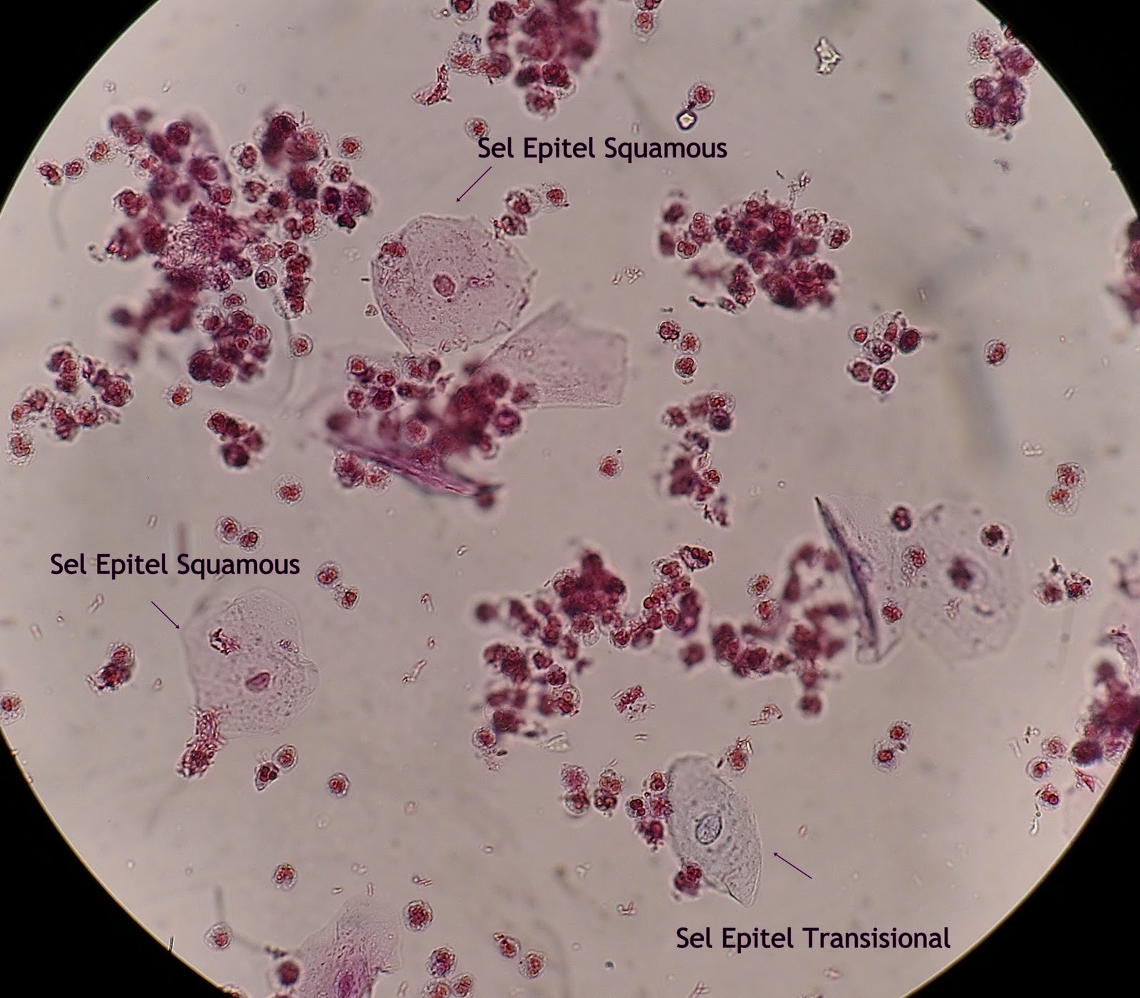 Sedimen Urine Metode Pewarnaan (Stainning) | Analis Kesehatan