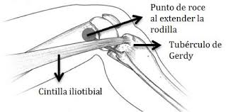 Traumatólogo de Guardia - Pedro Larrauri - Vigo.: Obtención de injerto ...