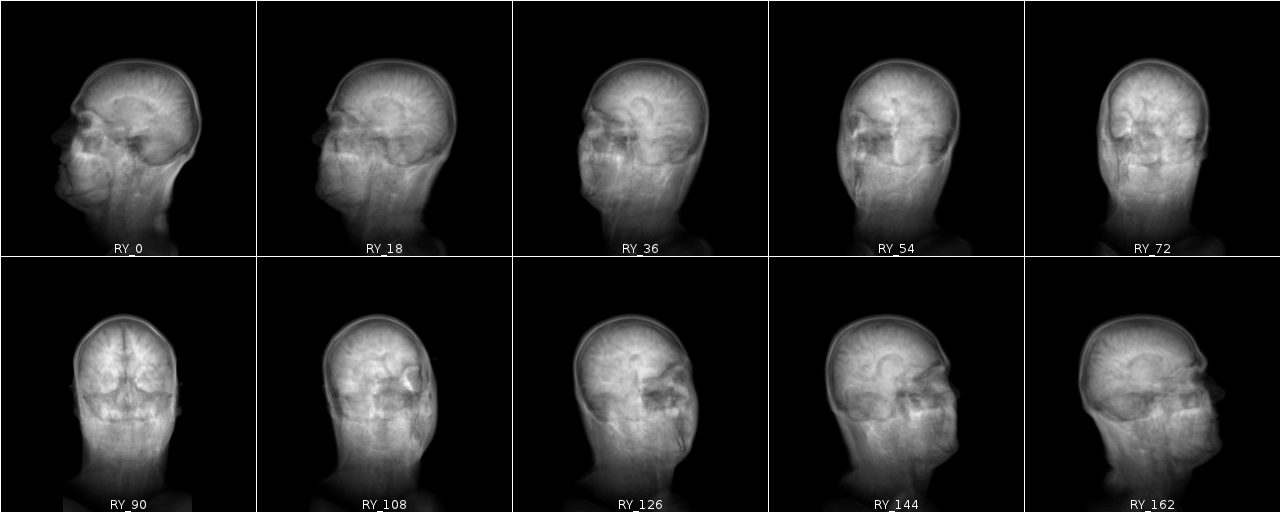 crazybiocomputing: Learning Tomography: Where are the sinograms?