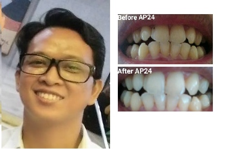 AP-24 Whitening Toothpaste Product Experience Review in 2020