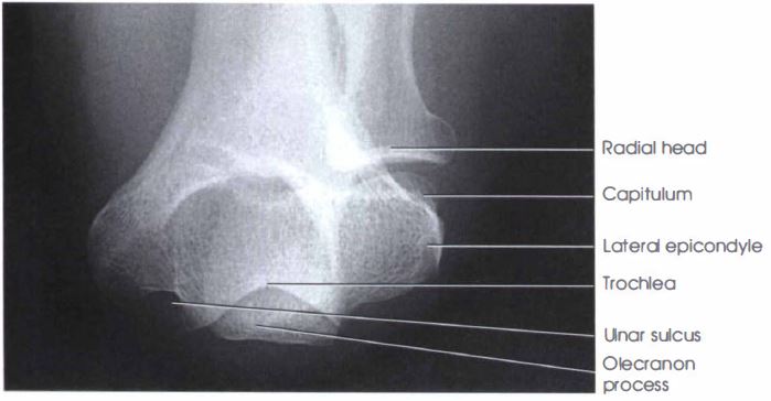 Distal Humerus (Elbow) - PA Axial Projection - RadTechOnDuty