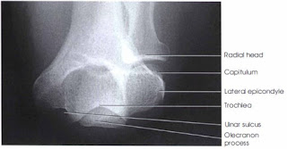 Distal Humerus (Elbow) - PA Axial Projection - RadTechOnDuty
